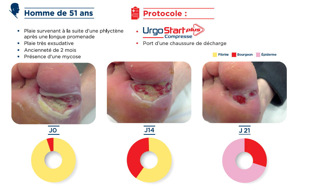 URGOSTART PLUS COMPRESSE - Urgo URGOSTART PLUS COMPRESSE - Urgo